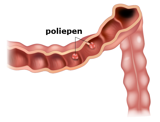 Coloscopie - Alrijne Ziekenhuis