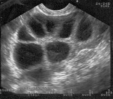 Informatie over IVF - Alrijne Ziekenhuis